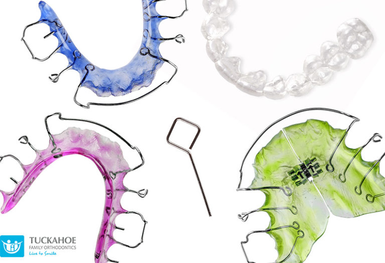 Retainer Wear is a Crucial Part of Orthodontic Treatment