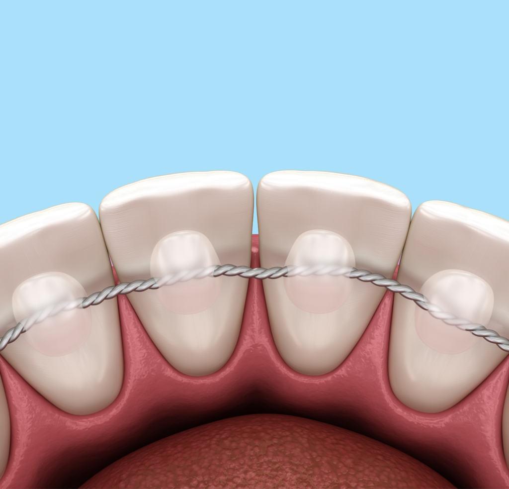 Orthodontist In New Rochelle NY - Braces & Invisalign New Rochelle Area